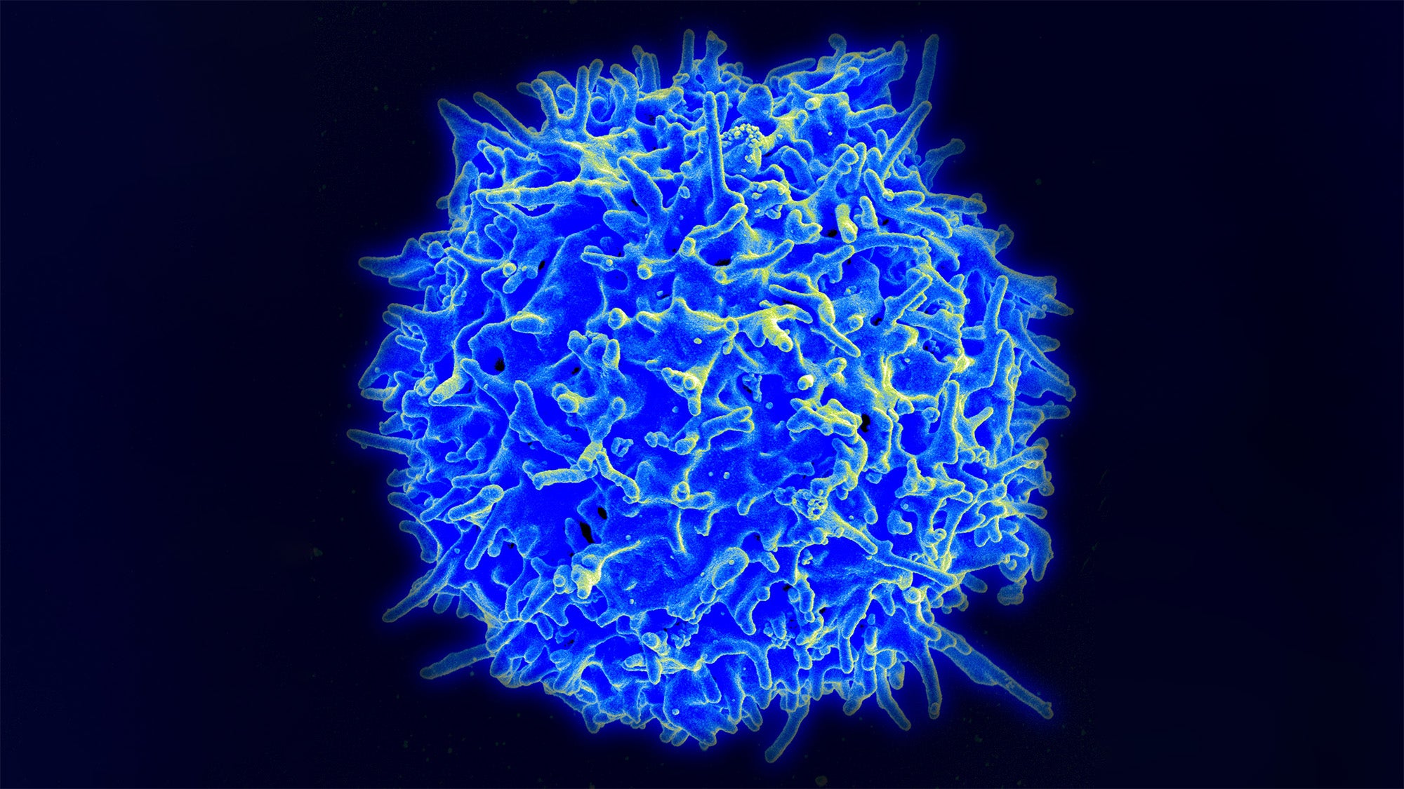 Fighting Cancer With the Immune System - Georgetown Lombardi